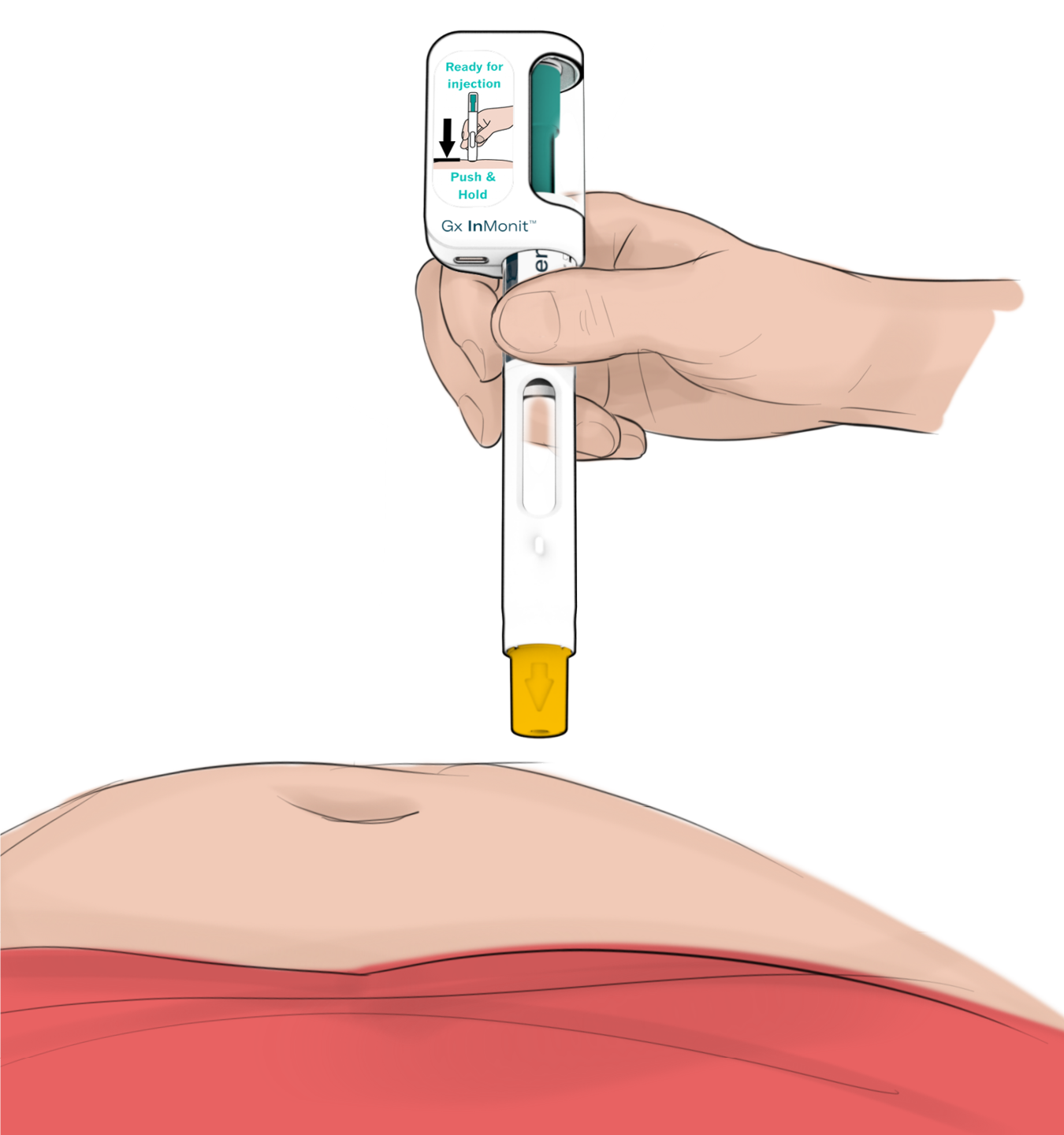 Smart Autoinjector Add-on for Adherence: Gx InMonit™ | Gerresheimer